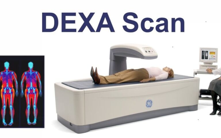 DEXA SCAN - Medicare